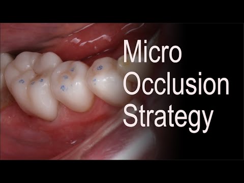 Number One Factor to Avoiding Tooth Pain