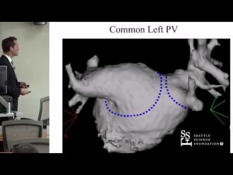 Atrial Fibrillation in 2015 by Darryl Wells, M.D.