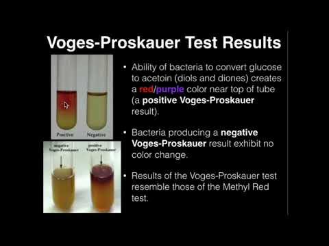Microbiology: Voges-Proskauer Test