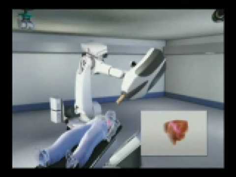 Synchrony® Respiratory Tracking System Demo - MedStar Franklin Square