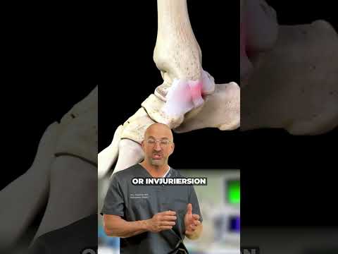 Worst Type of Ankle Sprain Injury #shorts
