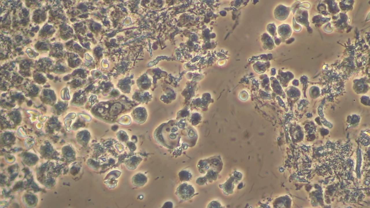 Amoeba killed with Salt