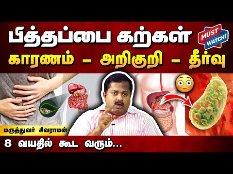 பித்தப்பை கல்: உங்களுக்கு இந்த அறிகுறிகள் இருக்கா? Dr. Sivaraman speech about Gallstones in Tamil