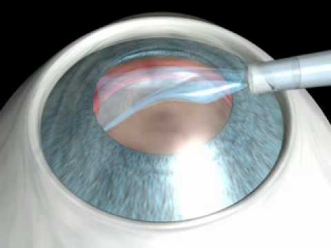 ICL animation by Eye7, Delhi , India