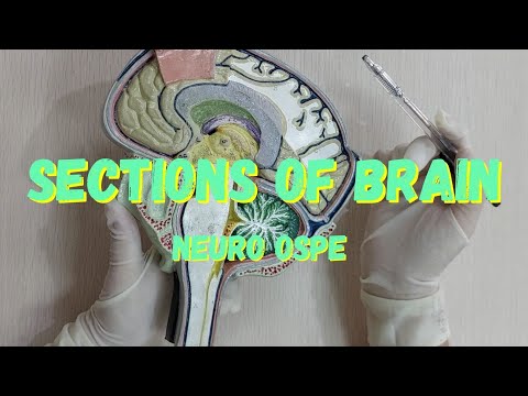 MEDIAN SECTION OF BRAIN | OSPE | NEUROANATOMY