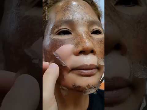 🔥Naturally Remove Dark Spots/Pigmentation 😱 | Best Remedy ✅ #shorts #youtubeshorts #skincare