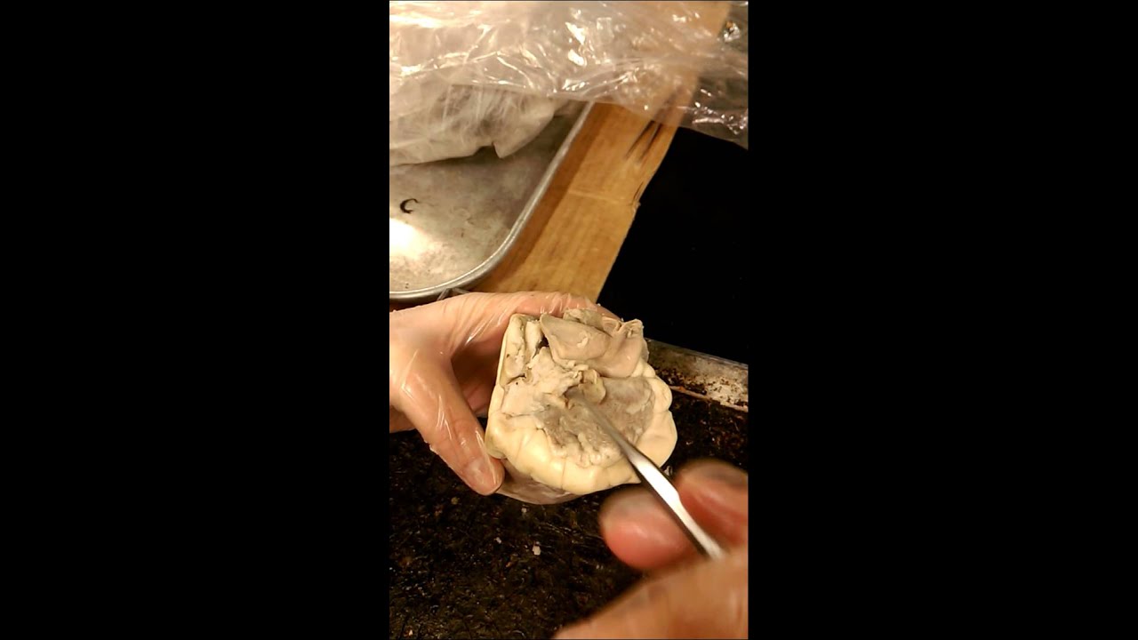 A&P2 - Lab Practical 1 - External Heart Features