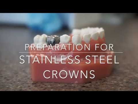 Stainless steel crown prep on a primary molar