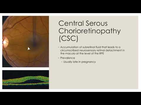 Pregnancy and the Eye