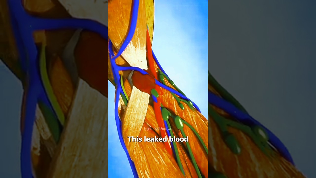 Blown Veins EXPLAINED! 🤯 Why Shots Sometimes Go Wrong! #viralvideo #shorts #sciencefacts #humanbody