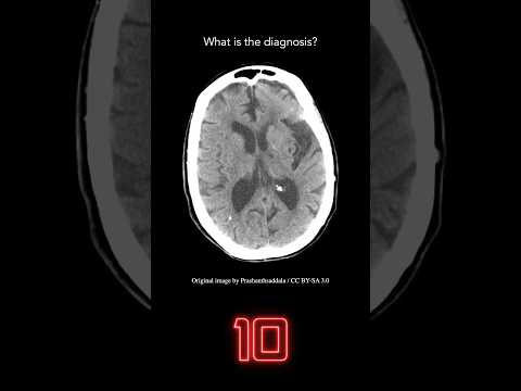 Brain CT Question 21