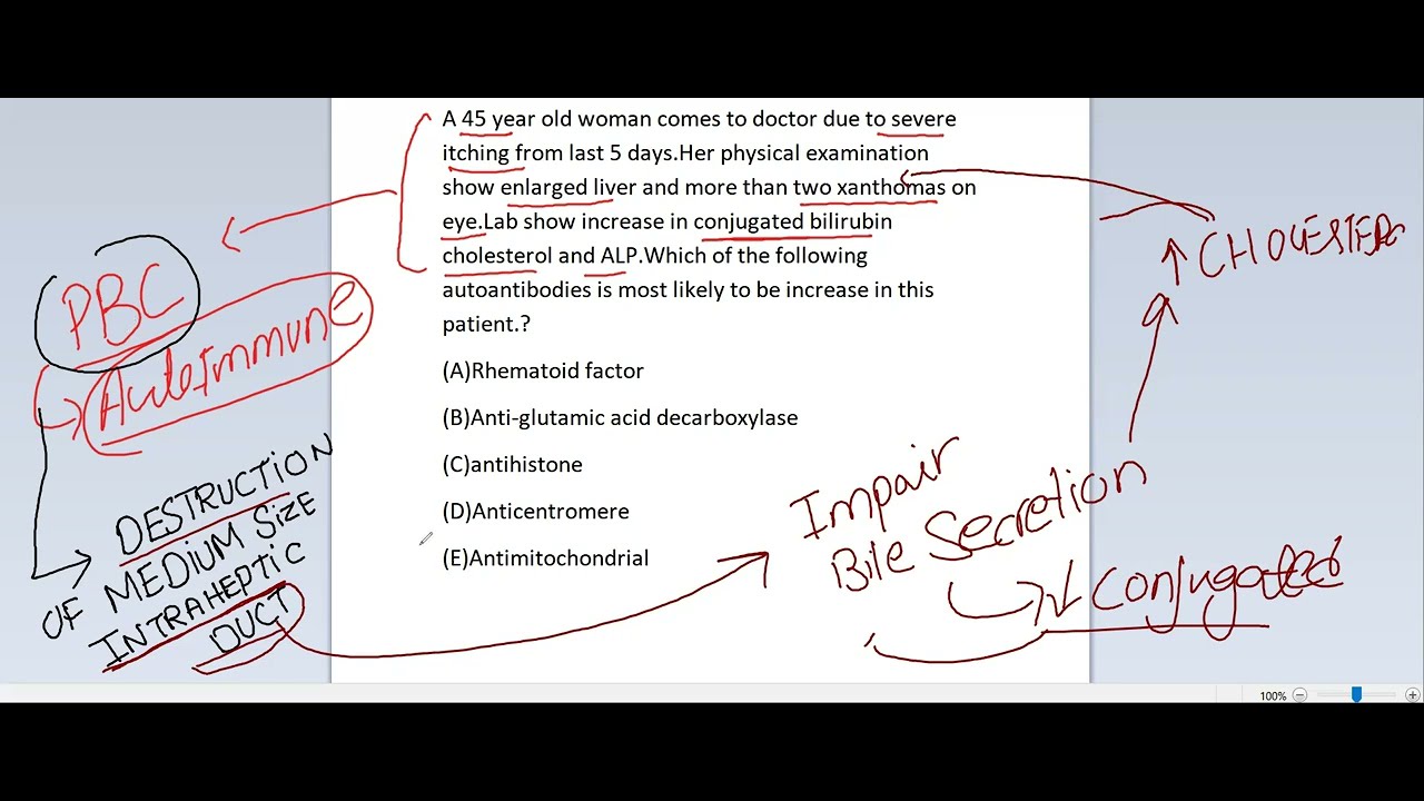 Primary biliary cholangitis/USMLE STEP 1 CK