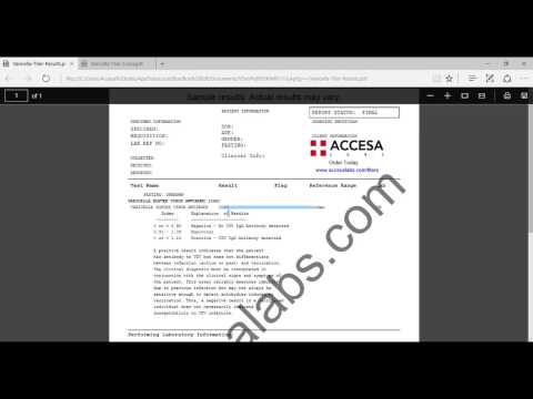 Varicella Titer - Chickenpox Titer Test Results Overview