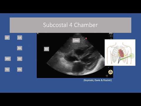 The Basics of TTE by Sarah Huber, MD Candidate Class of 2022