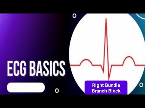 ECG Basics | Right Bundle Branch Block | Electrophysiology| Cause and Clinical significance of RBBB