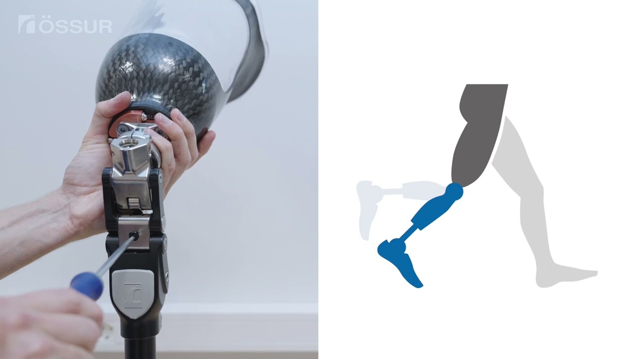 Total Knee 1900 - Clinician Fitting Tutorial