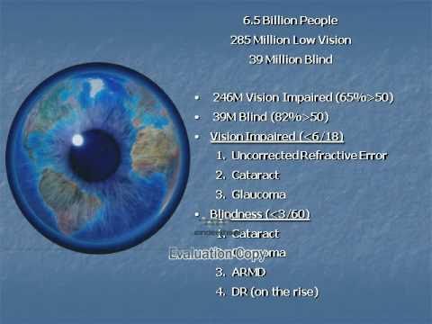 All in One Global Vision