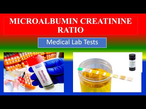 MICROALBUMIN CREATININE RATIO TEST - Lab Tests - What is ? , Uses , Need , Preparation , Results