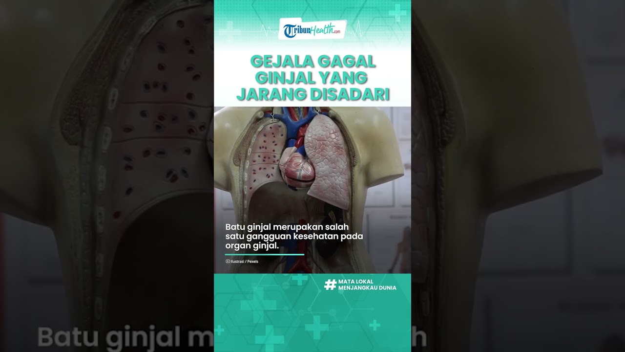 Gejala Awal Batu Ginjal Yang Jarang Disadari Termasuk Sakit Hingga