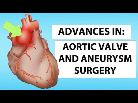 Patient Webinar: Advances in Aortic Valve & Aneurysm Surgery with Dr. Bavaria and Dr. Desai