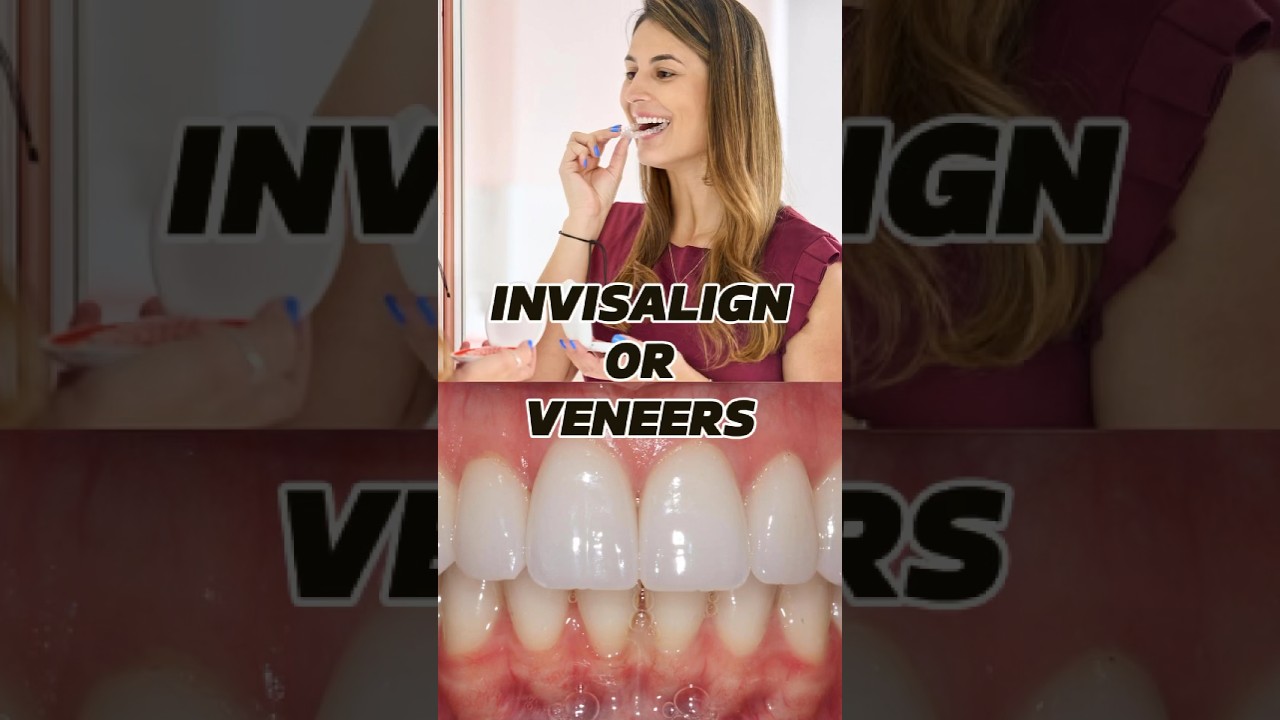 Ultimate comparison: Invisalign vs. Porcelain Veneers