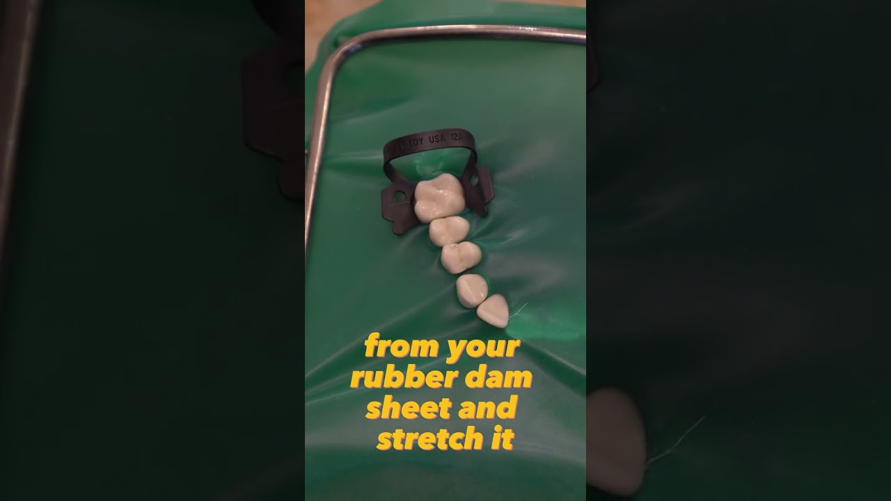 Top Rubber Dam Tips #2