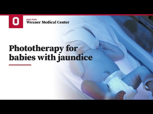 Photo Therapy Controller - Led Phototherapy Card Pcb Set Oem Service ...