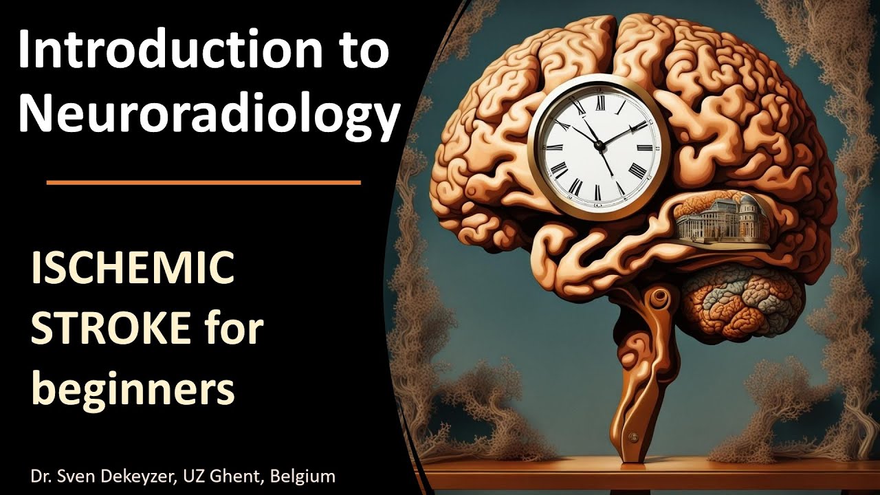 Imaging of Acute Ischemic Stroke: the basics!