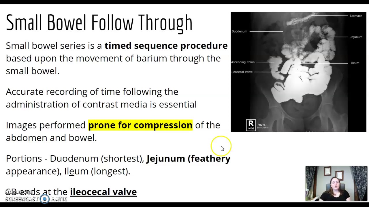 ARRT Procedures part # 5 - GI