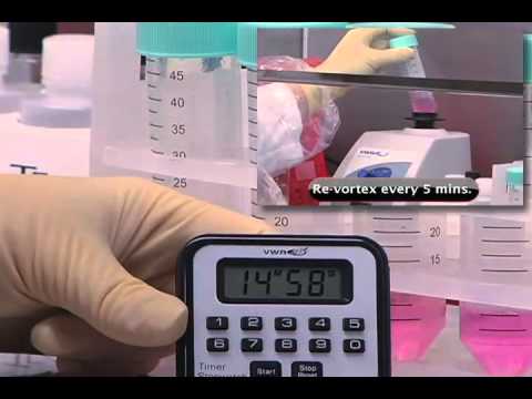 AFB Specimen Processing