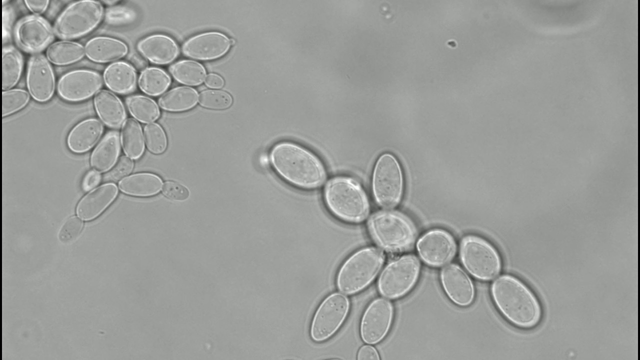 Baker's yeast timelapse