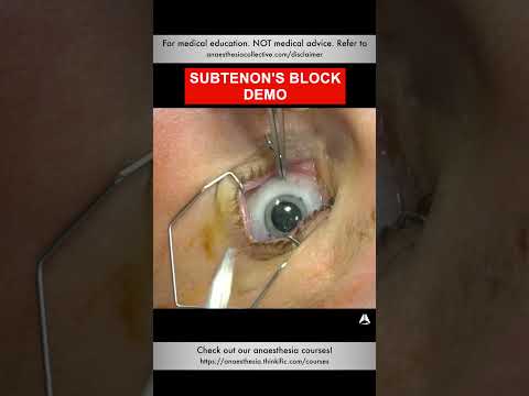 Subtenon's Block Demo | #shorts #ivcannulation #anesthesiology #nurse