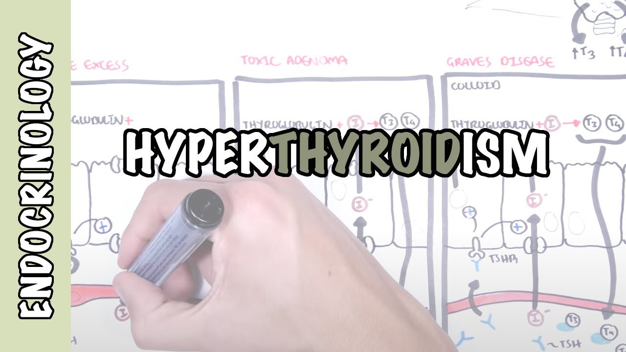 Hyperthyroidism Overview (causes, pathophysiology)