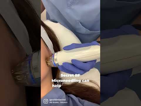 How can you shrink to pores?