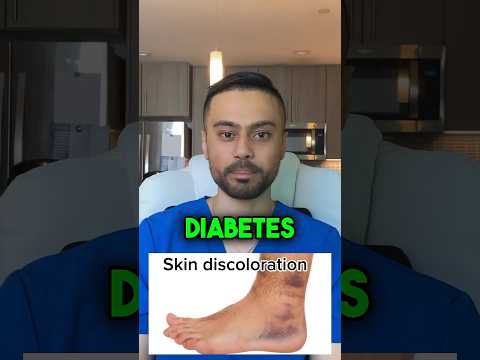 Diabetic Foot Skin Discoloration#health #medical #viral