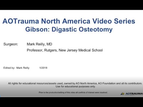 Hip Digastric Osteotomy via Gibson Approach