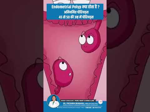 What is endometrial polyp ? Causes, Symptoms, Diagnosis - Best Gynae Clinic In Gurugram / Gurgaon