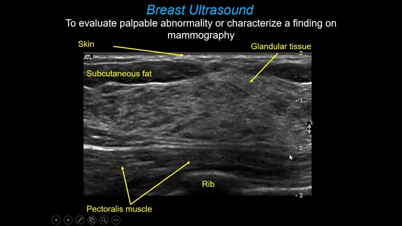 imaging Breast anatomy