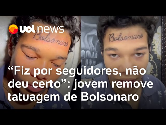 'Fiz por seguidores': jovem que tatuou 'Bolsonaro' na testa
