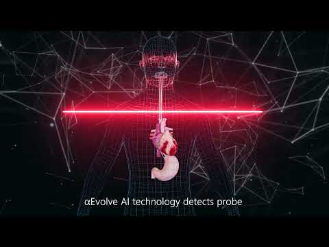 Echo Fusion for structral heart disease - 3D animation