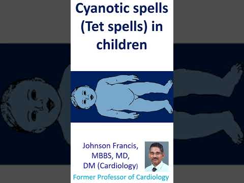 Cyanotic spells (Tet spells) in children