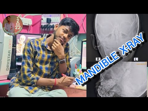 MANDIBLE X-RAY || AP VIEW || LATERAL OBLIQUE VIEW || DIGITAL X-RAY