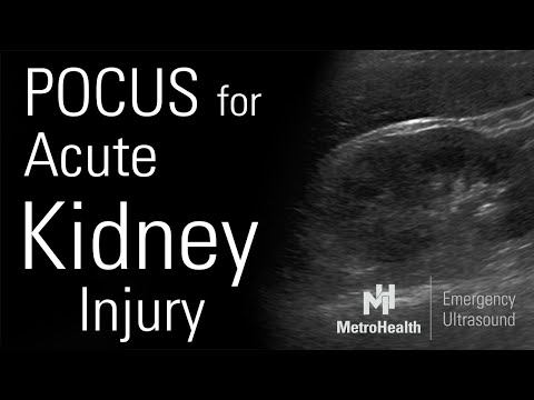 POCUS in Acute Kidney Injury