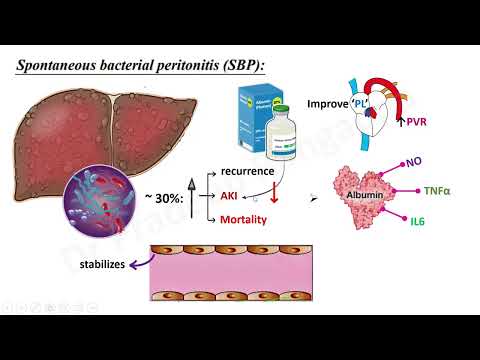 Albumin use in CLD (Chronic Liver Disease)_Dr Pradeep Rangappa