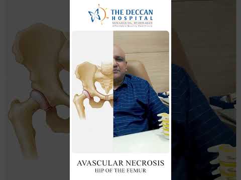 What is Avascular Necrosis (AVN)? | Why does it happen? How do you diagnose it? #deccanhospital