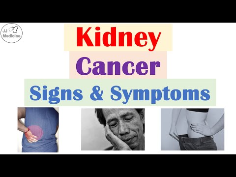 Kidney Cancer (Renal Cell Carcinoma) Signs and Symptoms (& Why They Occur)