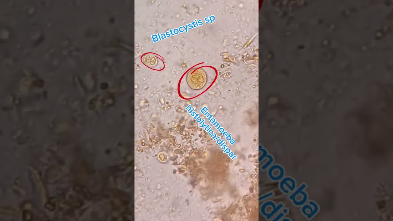 entamoeba histolytica under the microscope 🔬#microbiology #parasite #entamoeba #analysis #medical