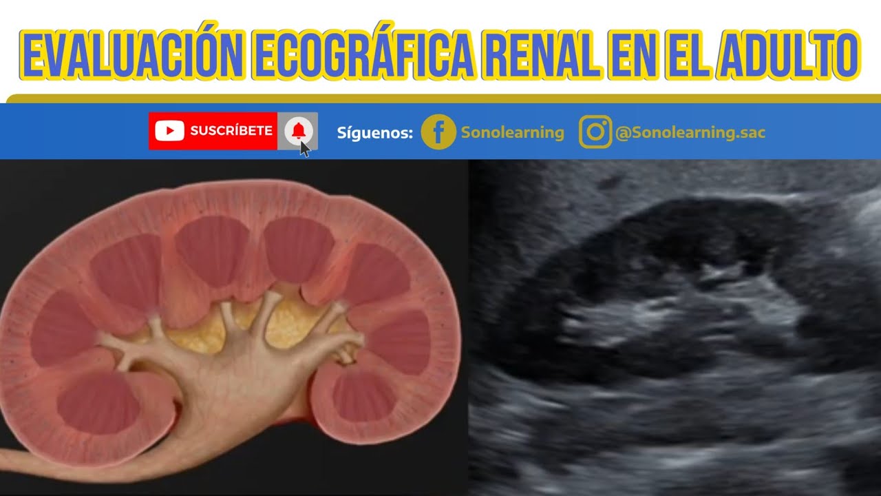 NORMAL ADULT RENAL ULTRASOUND EVALUATION