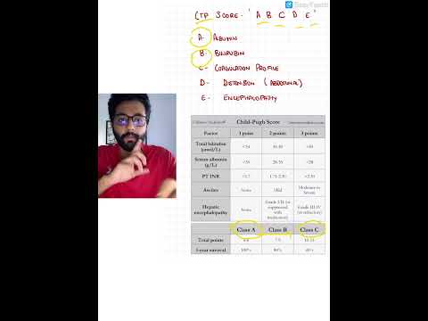 Child Pugh Score : Easy trick to memorise the criteria