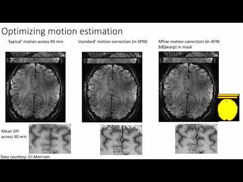 Renzo Huber: Ultra high resolution fMRI in the presence of motion
